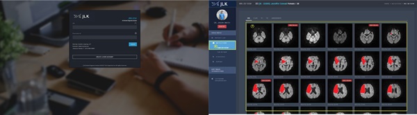 “AI로 판별하는 뇌졸중 진단, 응급상황 유용한 도구”