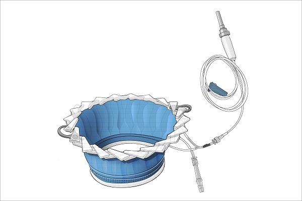 美 수술 보호 및 상처세척기 승인