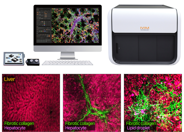아이빔테크놀로지, 생체 현미경 ‘IVM 시리즈’ 글로벌 출시