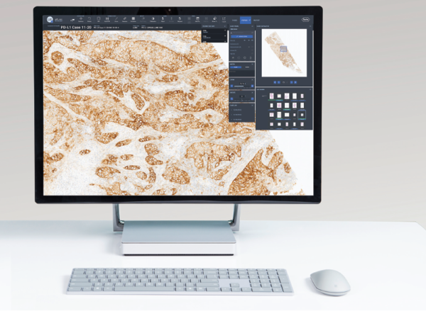 한국로슈진단, ‘uPath PD-L1’ 이미지 분석 알고리즘 출시
