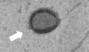 질병청, 첫 양성환자 검체서 ‘원숭이두창 바이러스 분리’ 성공
